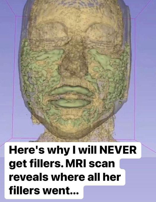 Doctor Reveals: MRI Scan Of The Face Of A 33-Year-Old Woman Reveals ...