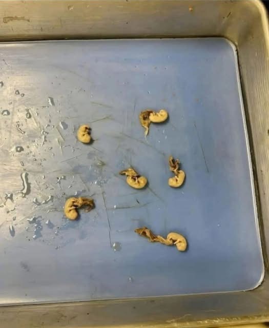 Beware the “Seeds in Your Snack”: How Hidden Threats Can Lurk in ...